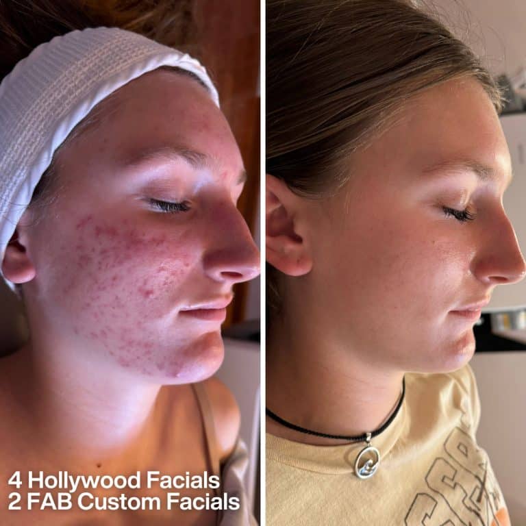 FAB Face and Body - Medical Spa in Battle Creek, MI